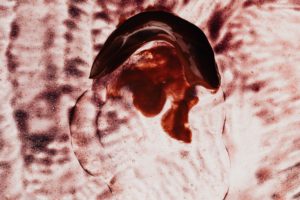 How to Identify the Difference Between Spotting and a Period